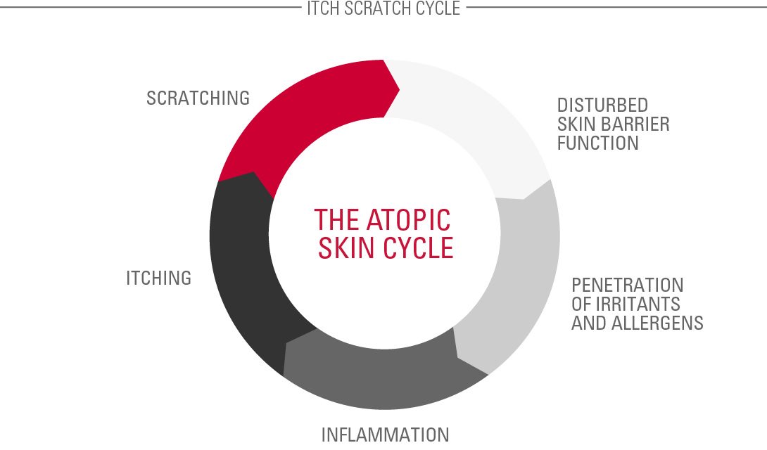 Eucerin: Atopic Skin | Facial Atopic Dermatitis